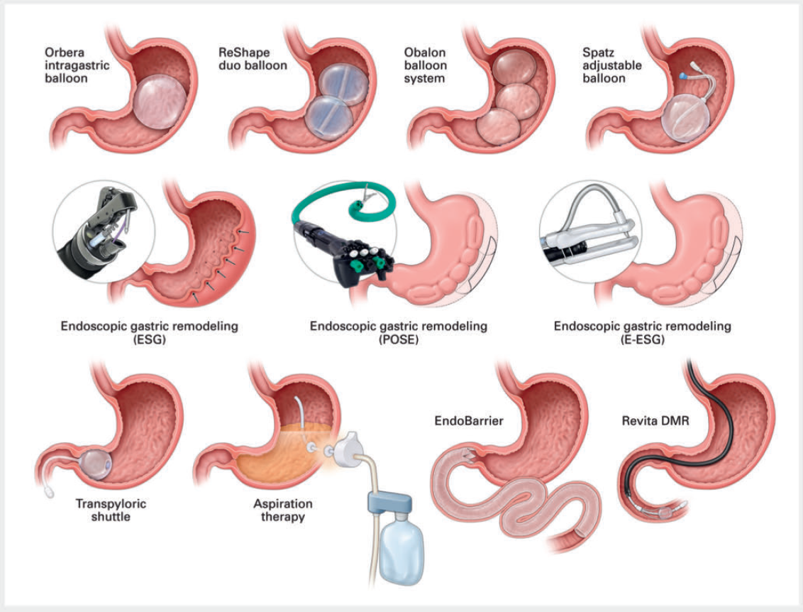 Article & Issues - Thieme Endoscopy